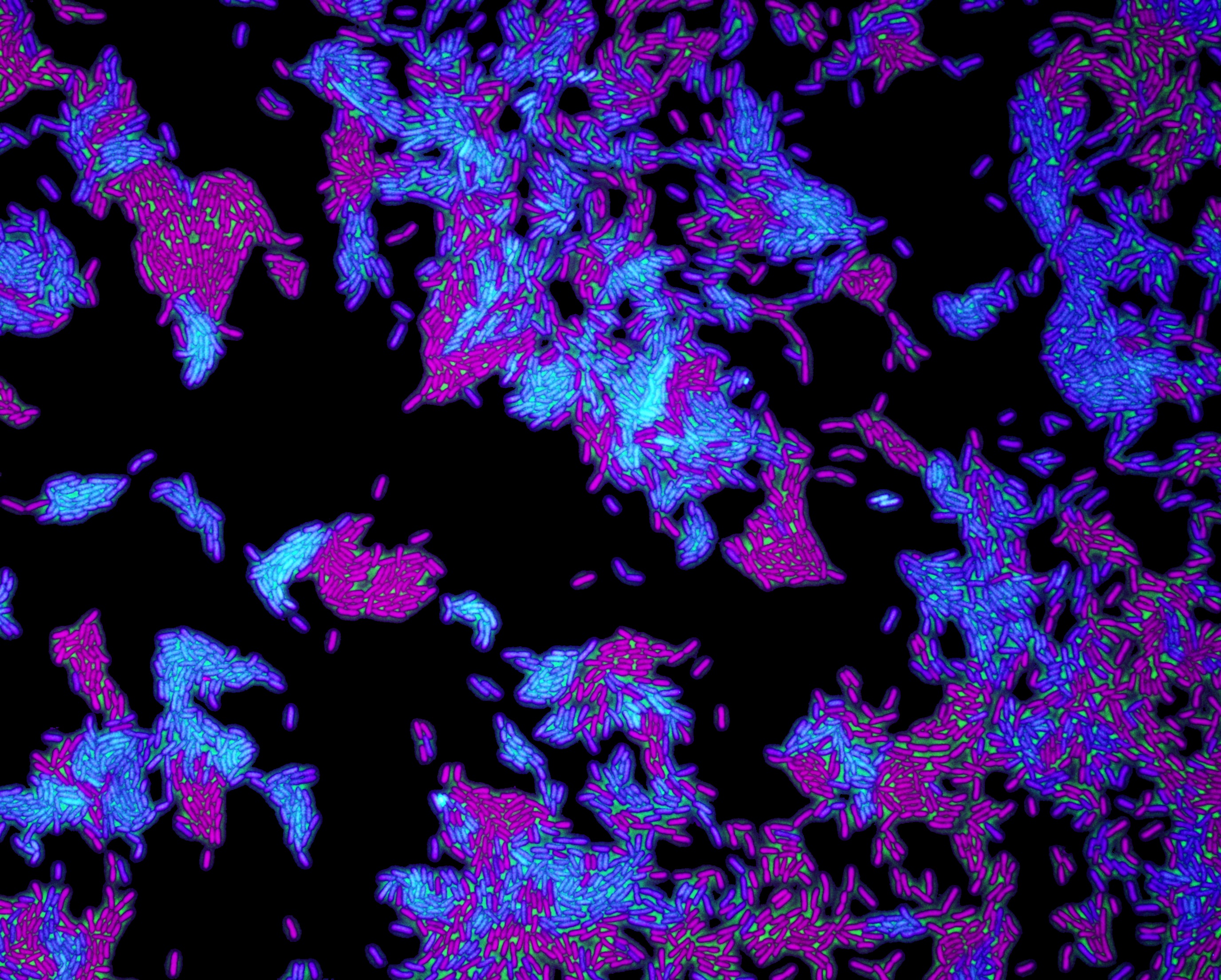 Common drug-resistant superbug develops fast resistance to ‘last resort ...